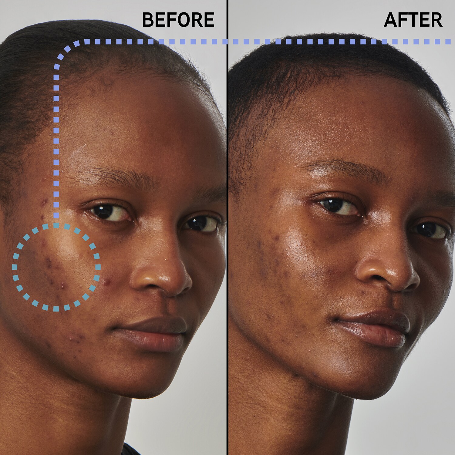 Lösung gegen überschüssigen Talg mit 20 % Niacinamid - Gesichtsserum ...